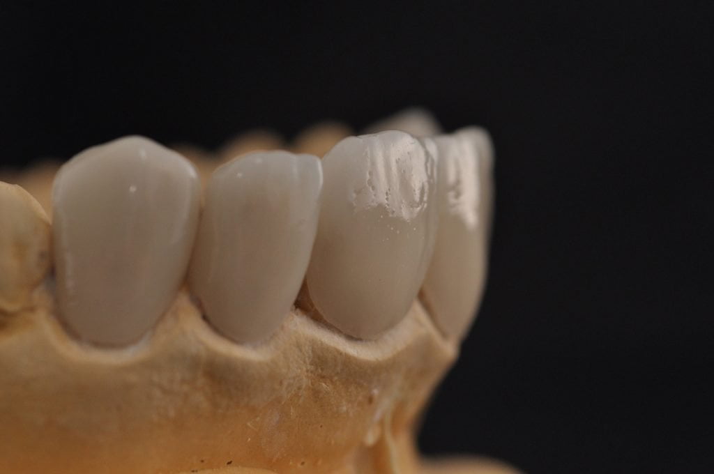 Salle de prothèse dentaire - Dr Deramchi, Dentiste Alger centre, Algérie